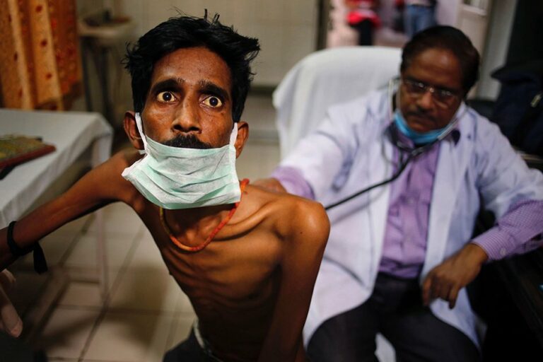All You Need To Know About Tuberculosis – Causes, Symptoms And ...