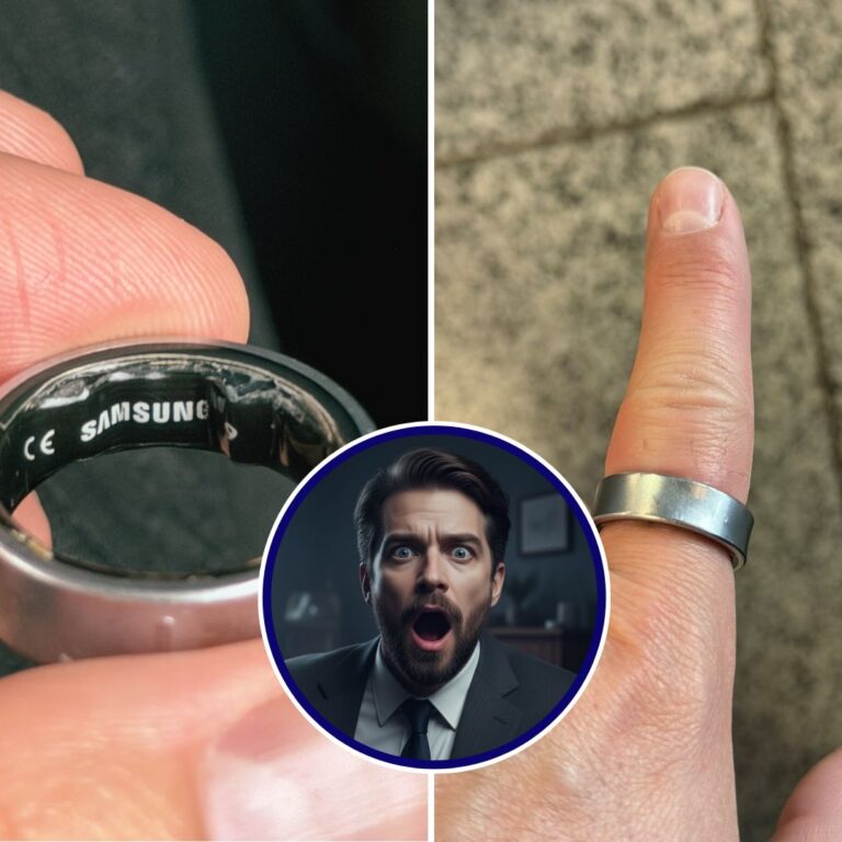 ‘Won’t Wear Smart Ring Again’: Samsung Galaxy Ring User Hospitalised As ...