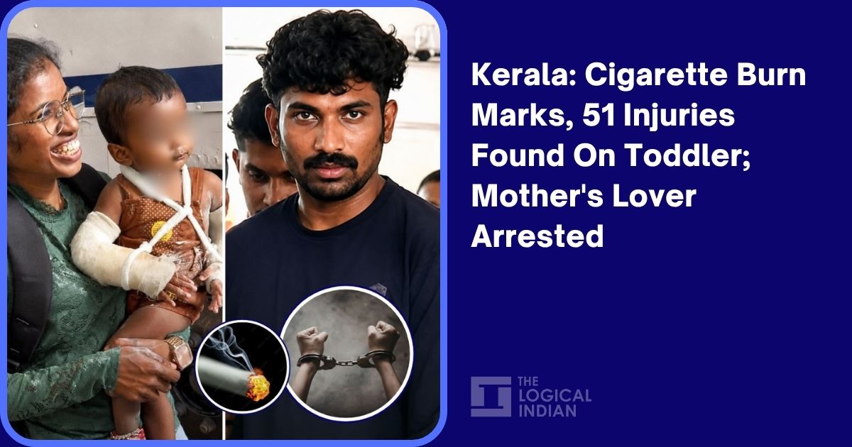 Kerala: Cigarette Burn Marks, 51 Injuries Found On Toddler; Mother's ...